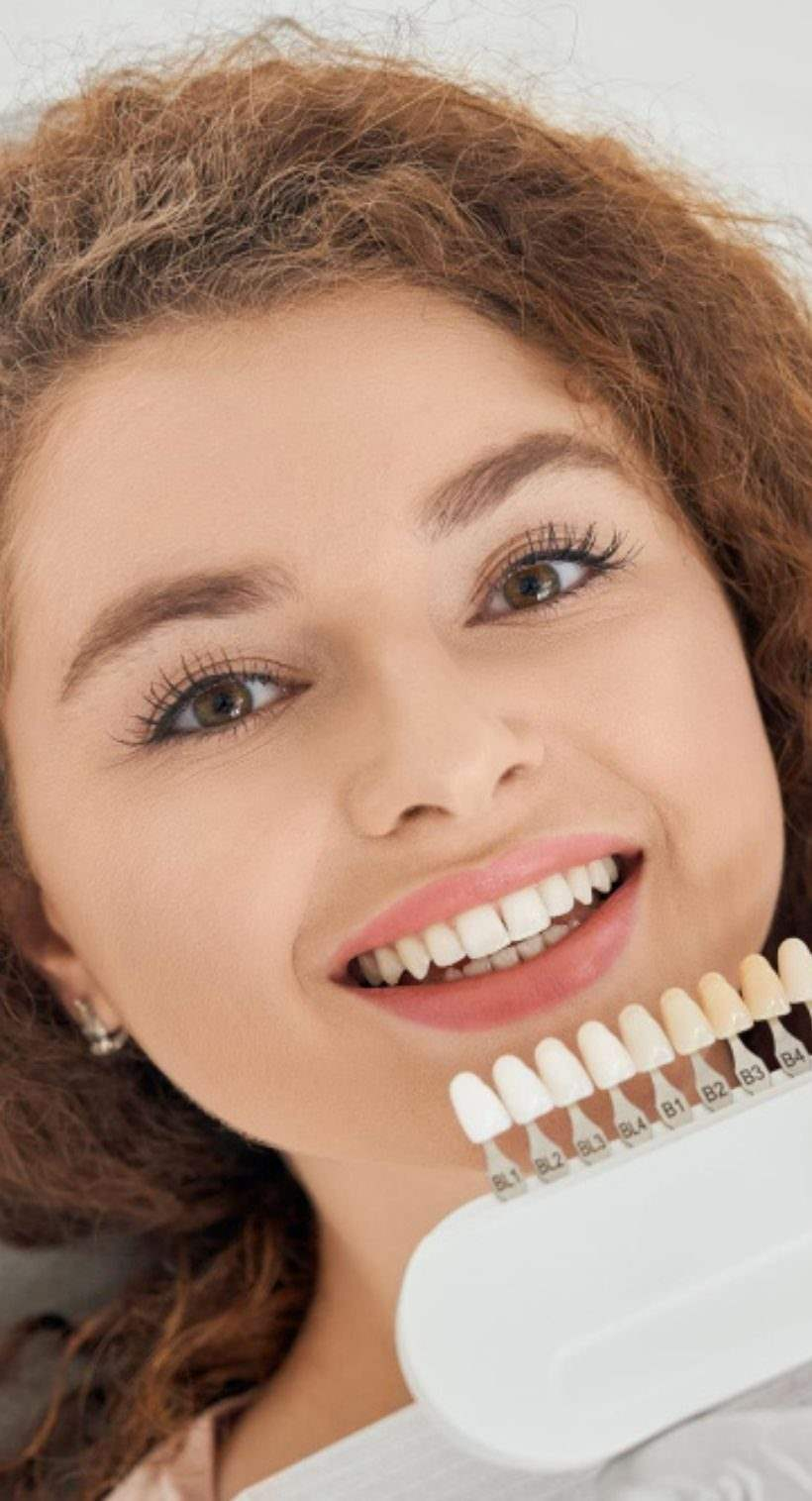 Polishing Veneers: - Signature Plus Clinic